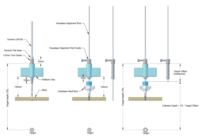 Laser Ablation – FHC